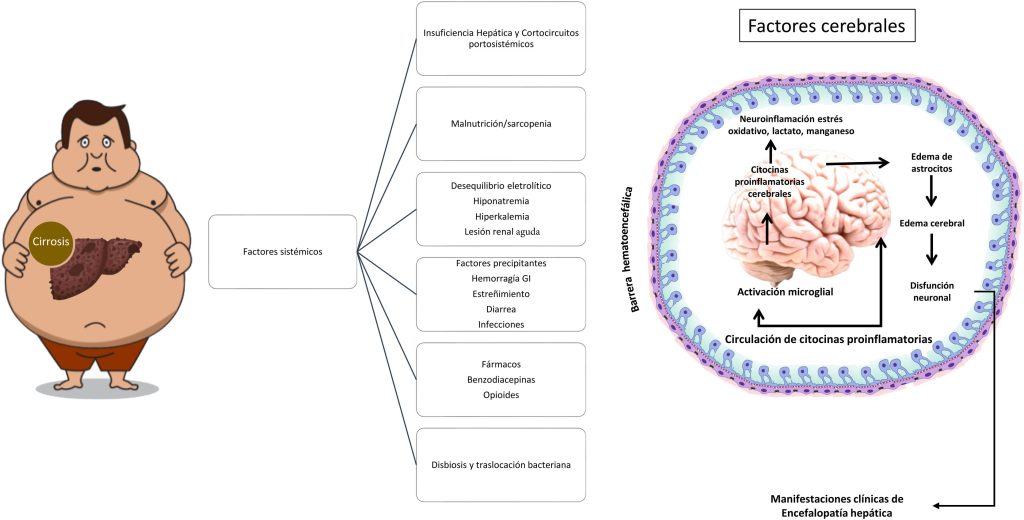 Asterixis: Completa Guía sobre Causas y Tratamientos - PSICOLOGÍAVITAE